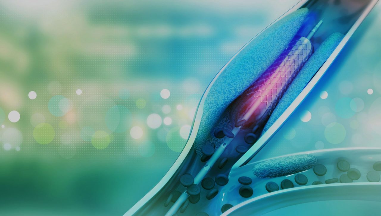 Integrating Medical Device Product Development with the Quality ...
