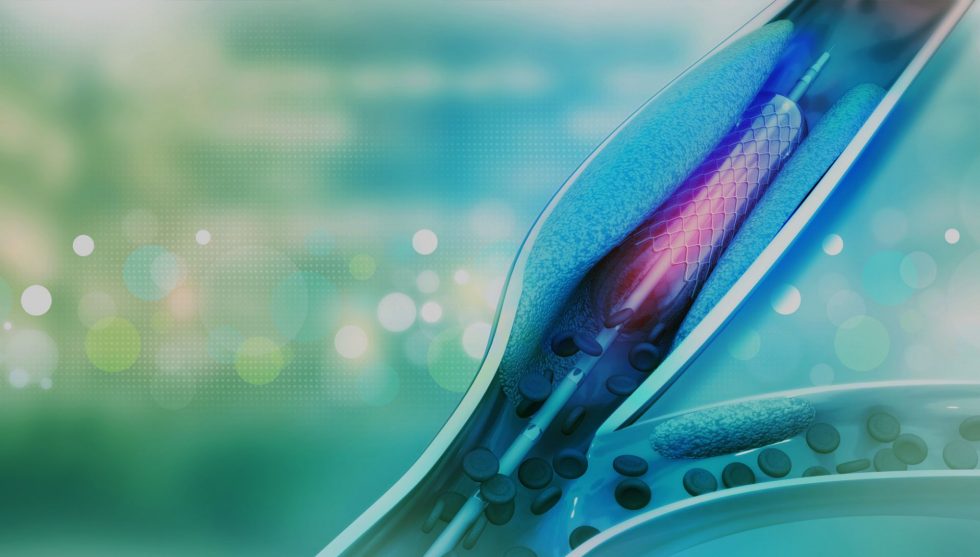 Integrating Medical Device Product Development with the Quality ...